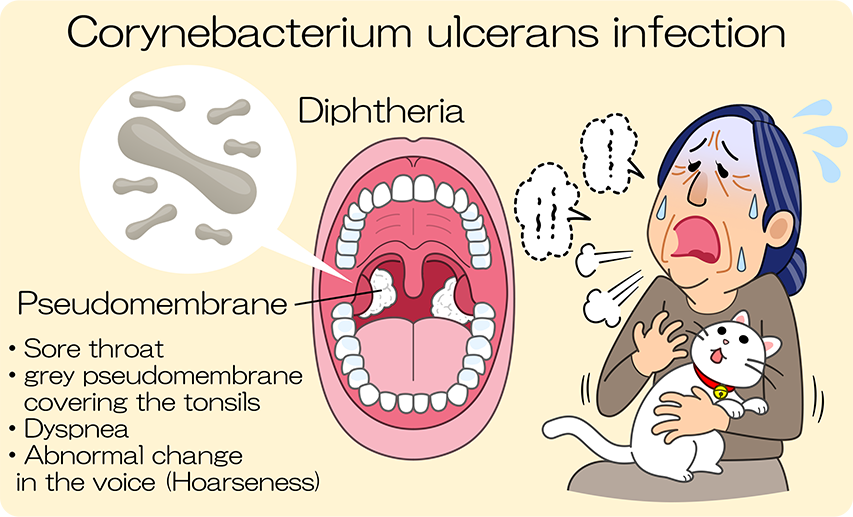 Diphtheria | Serum therapy